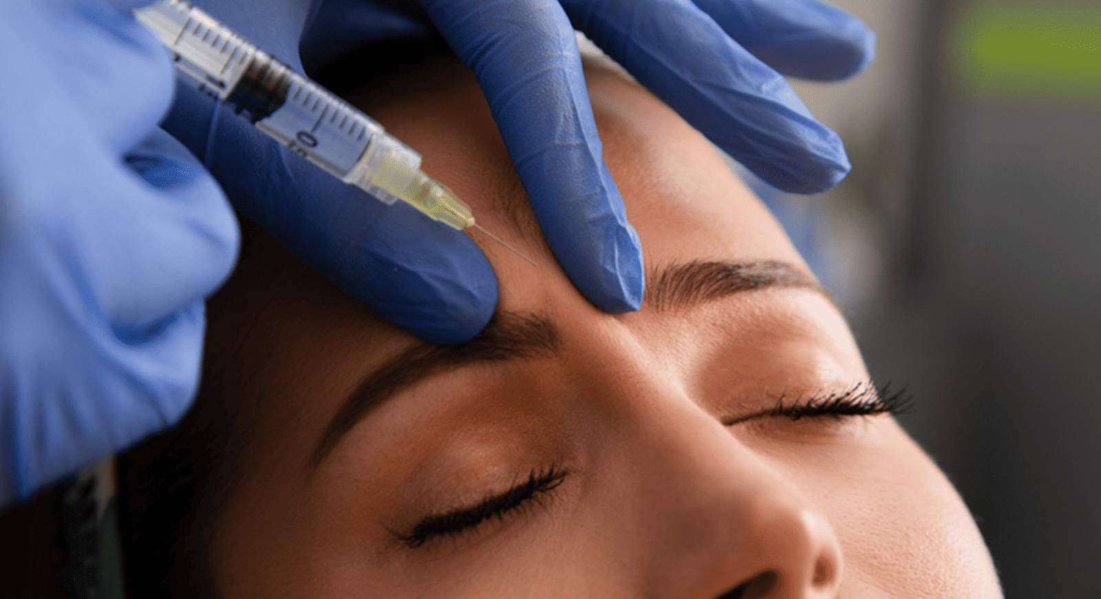 What to Do After Botox in Forehead? - Talking Tan